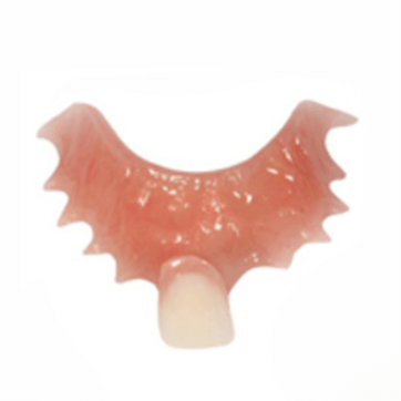 Flipper Tooth Replacement