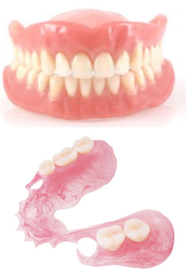 The Pros and Cons of Partial Dentures, Explained